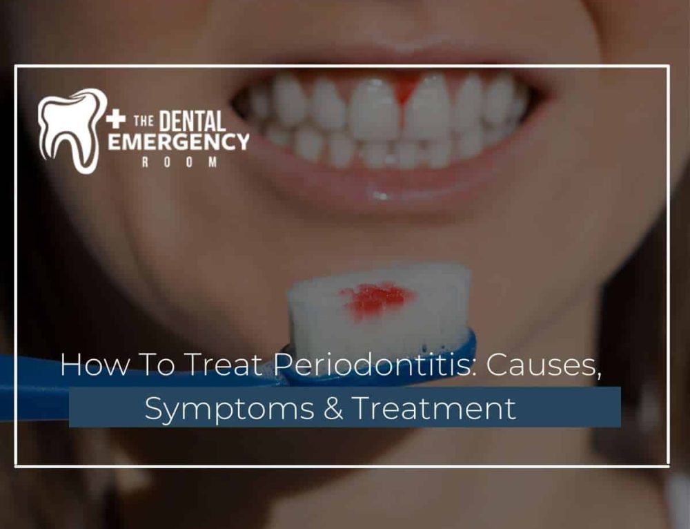 The Connection Between An Infected Tooth & Bone Loss