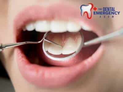 What to Do When a Filling Falls Out & Causes Pain