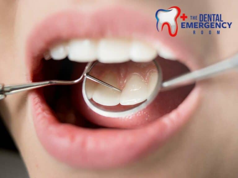 What to Do When a Filling Falls Out & Causes Pain